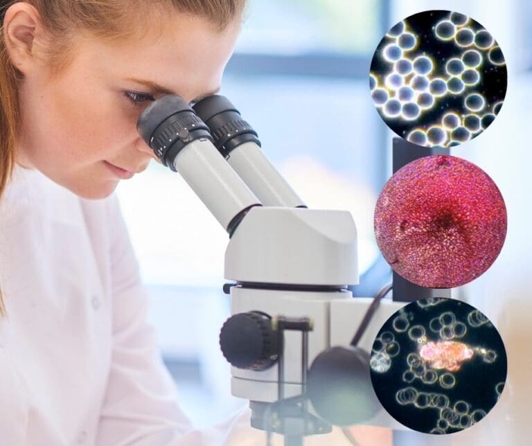 Master the Art of Blood Analysis: Join Our Live Blood Cell Microscopy ...